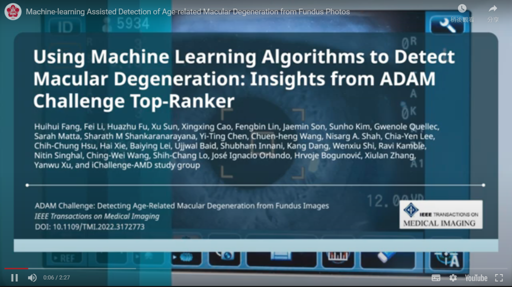 [news ] Ncku Researchers Demonstrate Machine Learning Assisted Detection Of Age Related Macular